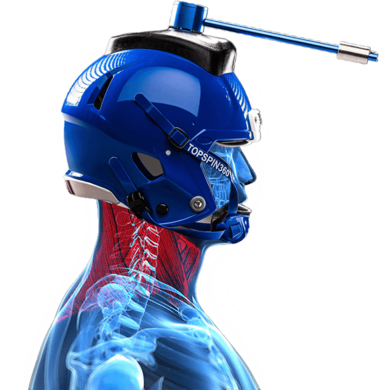 TopSpin360: Neck Strength Equipment to Reduce Concussion